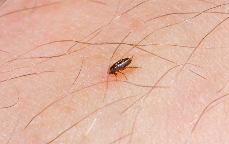 Can Fleas Live On Humans? | Miche Pest Control